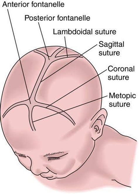 Newborn Sutures Medizzy