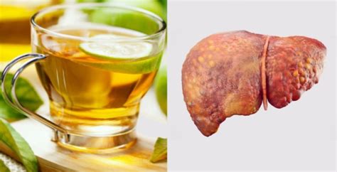 დალიეთ ეს სასმელები ღამით რათა ძილში გაიწმინდოთ ღვიძლი და დააჩქაროთ ცხიმის წვა