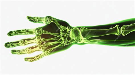 Glowing Green Bones A Side View Of A Mans Wrist Premium Ai Generated