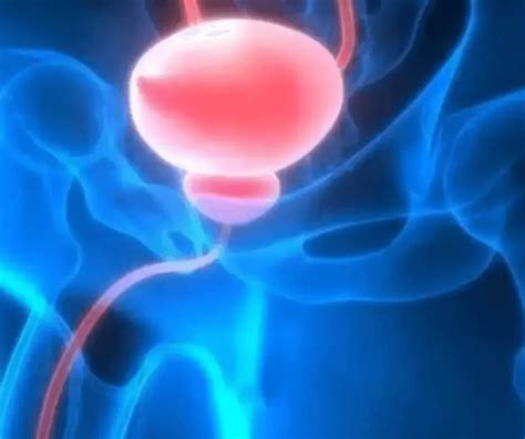 Can Mri Based Ai Enhance Risk Stratification In Prostate Cancer