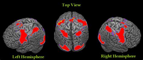 Brain Regions Activated By Observation Effect Incongruent Congruent Download Scientific