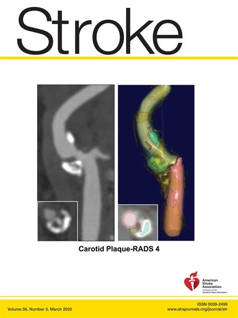 Impact Of Conventional Stroke Risk Factors On Early And Late Onset