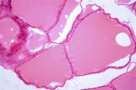 Thyroid Gland Under A Microscope Light Micrograph Exhibiting Typical