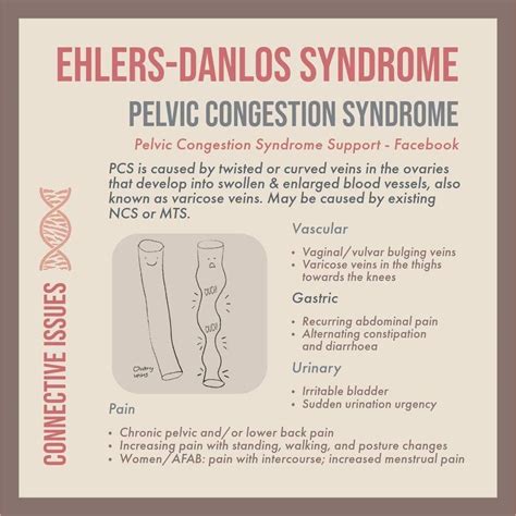 Pin By Renee Mann On Ehlers Danlos Syndrome In 2024 Pelvic Congestion
