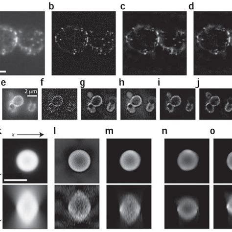 pdf optical sectioning microscopy