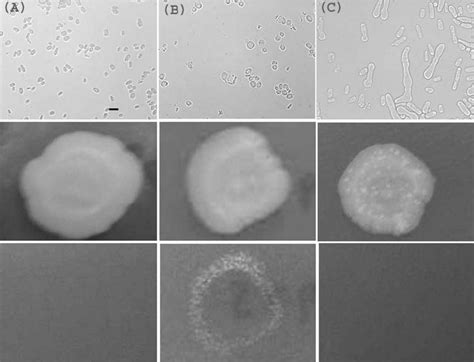 Pseudohyphal And Invasive Growth Of S Pombe Ncyc132 Yeast Were Grown