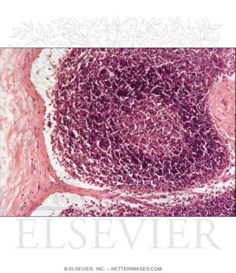 Higher Magnification Light Micrograph Of Part Of A Lymph Node Cortex