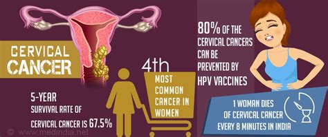 Quiz On Cervical Cancer