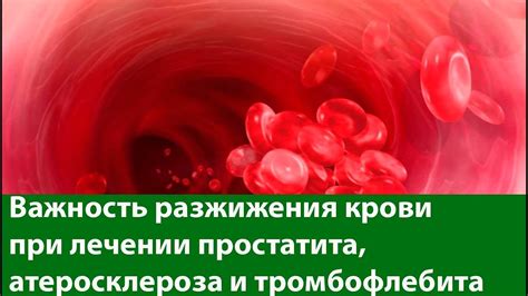 Лечении простатита народными средствами в домашних условиях Разжижение