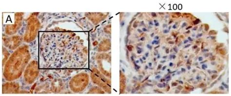Ihcif 结果如何统计、作图？一篇讲全 丁香园