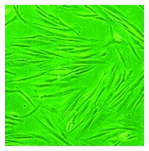 A Shows Phase Contrast Micrographs Of Untreated Control Hdmscs With