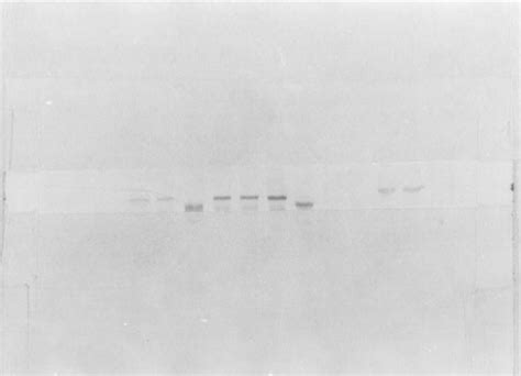 Western Blot Analysis Of Exon Deletion Ferrochelatase Mutants Cell