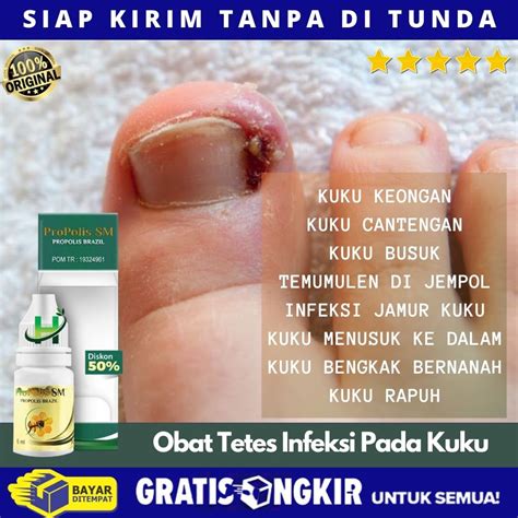 Obat Temumulen Id