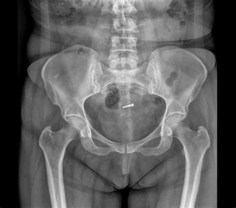 Portable Digital Radiography System From China Manufacturer Dawei Medical