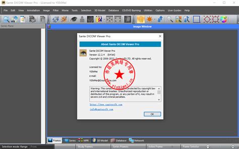 医学影像查看软件sante Dicom Viewer Pro 12 2 4的下载、安装与注册激活教程