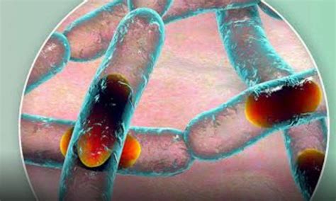 20 Facts About Anthrax Disease National Daily Newspaper