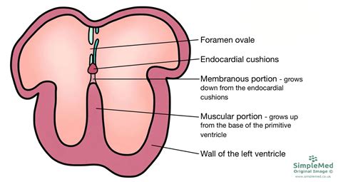 Interventricular Septum Development