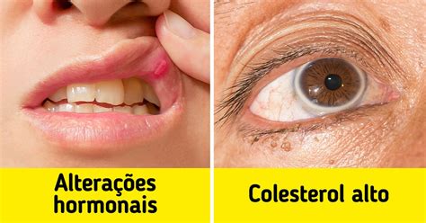 8 Sinais de alerta que seu corpo pode estar dando e que você não deve ignorar Incrível