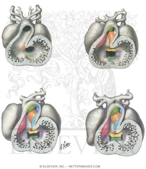 Spiral Aorticopulmonary Septum