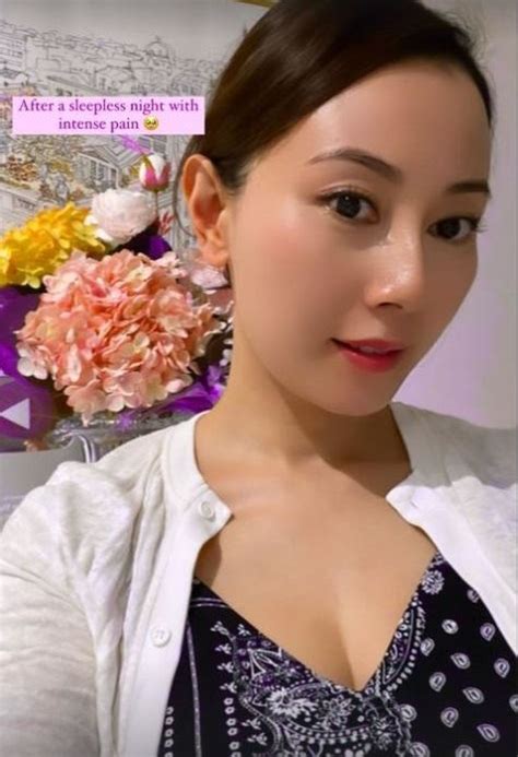 38歲袁嘉敏突然自爆胸部劇痛入院照X光 身體響警號惹猜測原來係後遺症 UHK 港生活