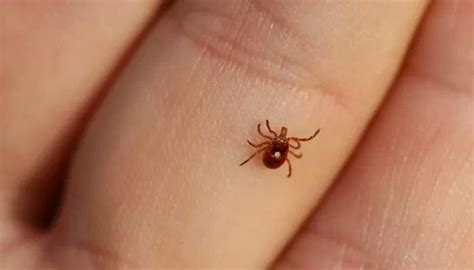 Crimean Congo Fever Claims 10 Lives In Iran Tehran Times