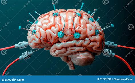 Brain Stimulation Conceptual Image Stock Illustration Illustration