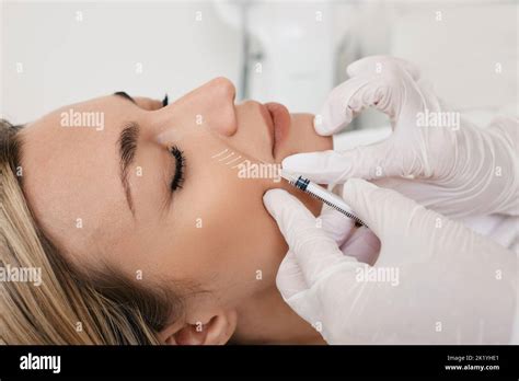 Beautician Doing Injection Into Nasolabial Folds To Female Patient