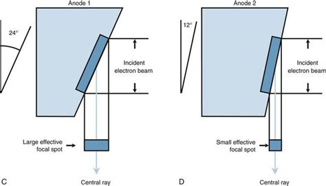 X Ray Tube Types And Components Explained