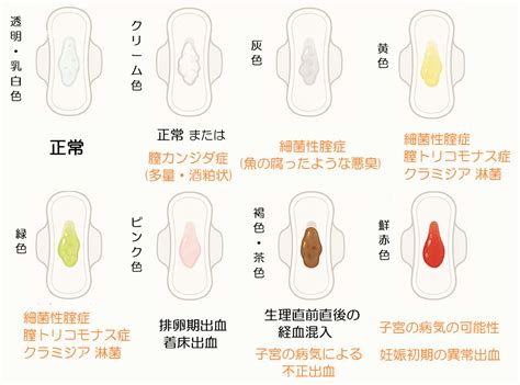 黄色いおりものが出る原因とは？ 色の変化からわかる体のサインと正しい対処法 性の悩み「生育」