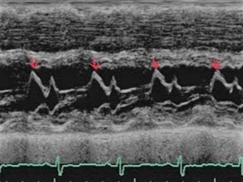 Week Quiz Flashcards Quizlet Week Quiz Flashcards Quizlet
