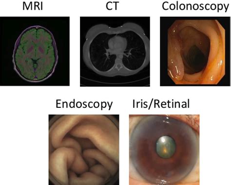 Figure 1 From Compressive Sampling Of Color Retinal Image Using Spread Spectrum Fourier Sampling