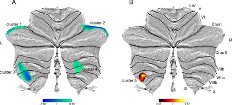 Vbm Results Projected Onto The Flatmap Of The Human Cerebellum A