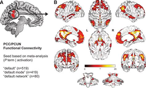 Posterior Cingulate Cortexprecuneus Seed Based Functional Connectivity