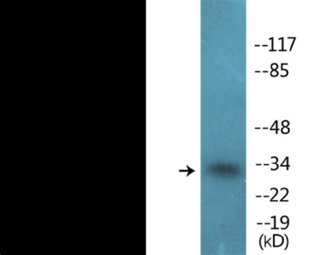 Cdk1 Cdc2 Colorimetric Cell Based Elisa Kit