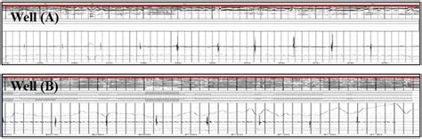 Well Logging Data Of Well A And Well B Download Scientific Diagram