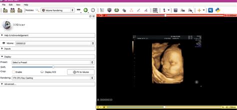 3d Ultrasound Dicom Import Error Reference Image In Series Does Not Contain Geometry