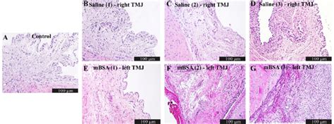 Photomicrographs Of The Tmj Synovial Membrane A Normal Tmj Synovial