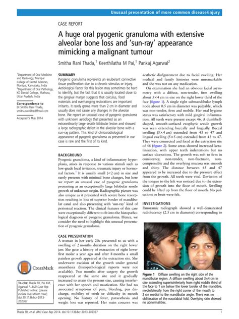 A Huge Oral Pyogenic Granuloma With Extensive Download Free Pdf