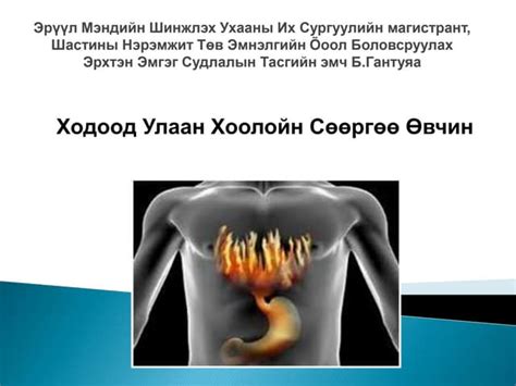 ходоод улаан хоолойн сөөргөө өвчин Pptx