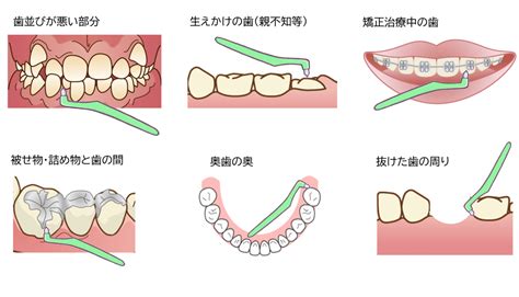 歯の救世主～タフトブラシ 船橋市東船橋の歯医者「ビバ歯科･矯正小児歯科」