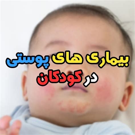 شایع ترین بیماری های پوستی در کودکان درمان هر کدام دکتر کاغذی
