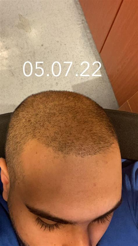 Incoming Smp Head R Smpchat