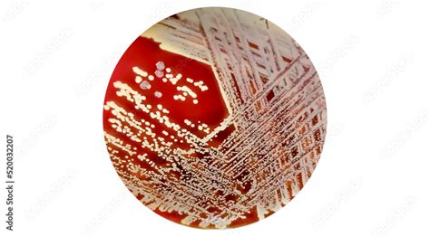 Staphylococcus Aureus Gram Positive To Gram Variable Nonmotile