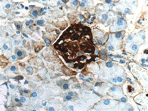 Ins1 Antibody 28588 1 Ap Proteintech