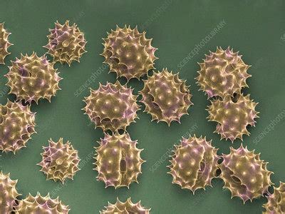Daisy Pollen SEM Stock Image B786 0790 Science Photo Library