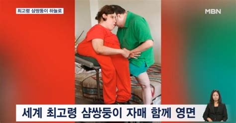 세계 최고령 샴쌍둥이 자매 62세에 함께 하늘나라로