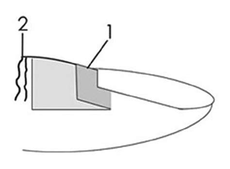 Comparing The Use Of Traditional Sites And Alternative Sites Puncture