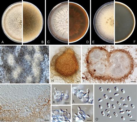 Didymella Degraaffiae Cbs 144956 A B Colony On Oa Front And Download Scientific Diagram