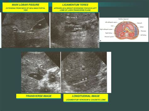 Lackawanna College Diagnostic Medical Sonography Program Ppt Download
