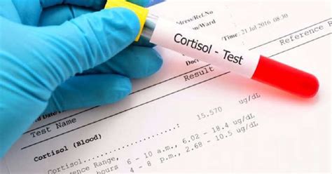 Heres What Happens When You Take A Cortisol Blood Stress Test